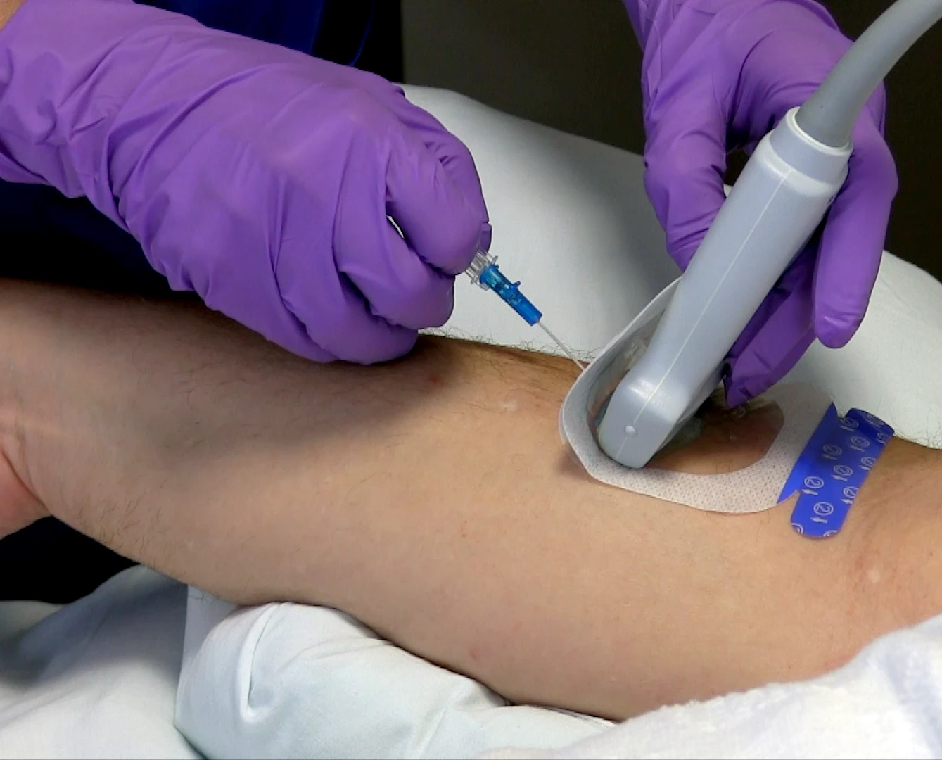 All-In-One Ultrasound Mastery Certificate Training Start to Finish ...